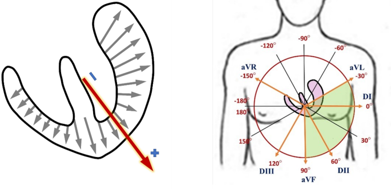 Eje eléctrico del corazón - CampusCardio